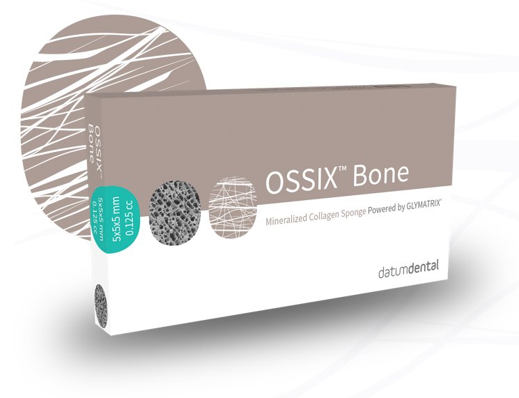 OSSIX™ Bone: Mineralized Collagen Sponge Powered by GLYMATRICS®
